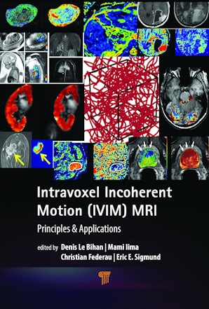 Intravoxel Incoherent Motion (IVIM) MRI